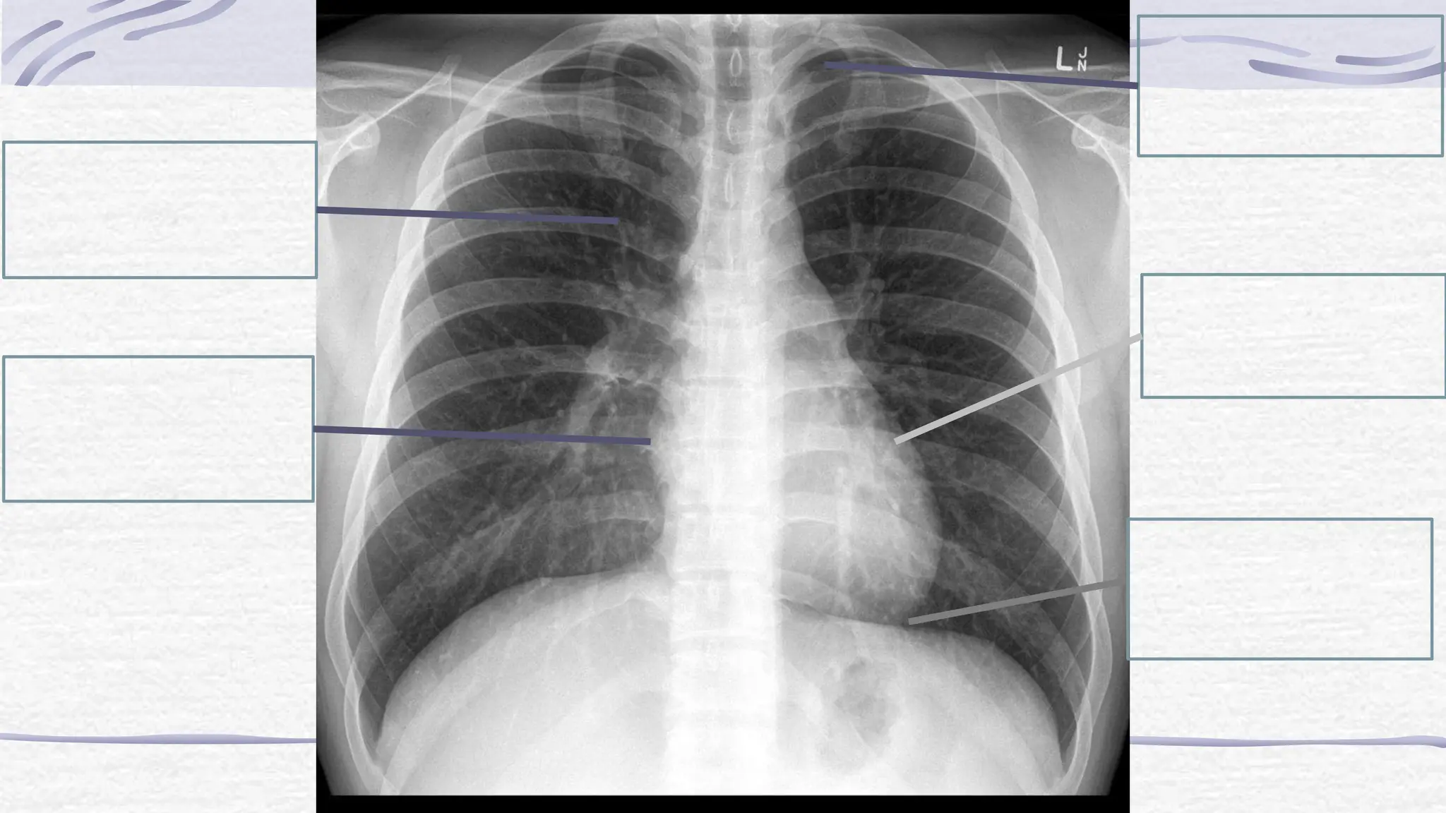 anatomy thorax human title radiologi positioning | PPTX