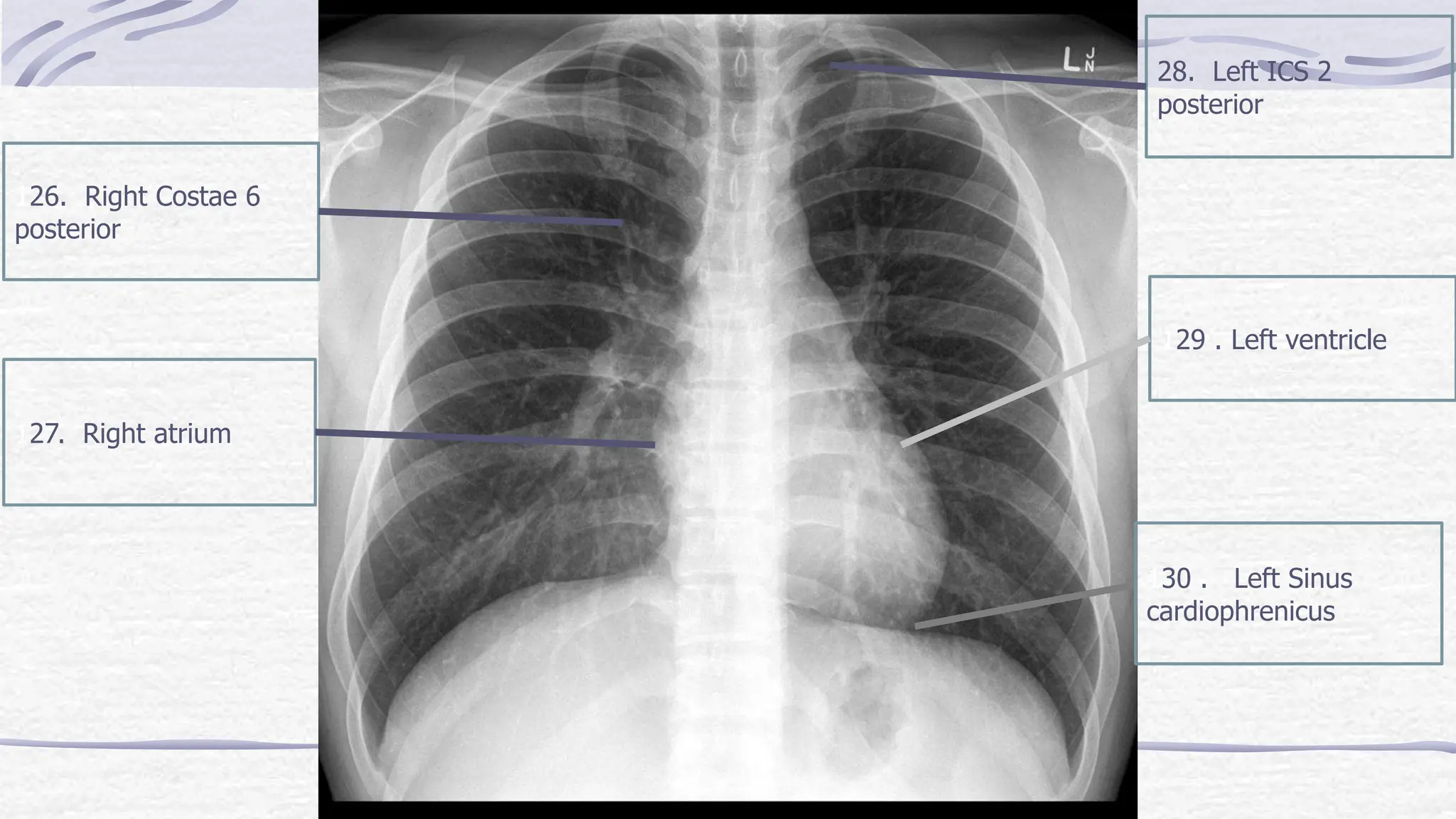 anatomy thorax human title radiologi positioning | PPTX