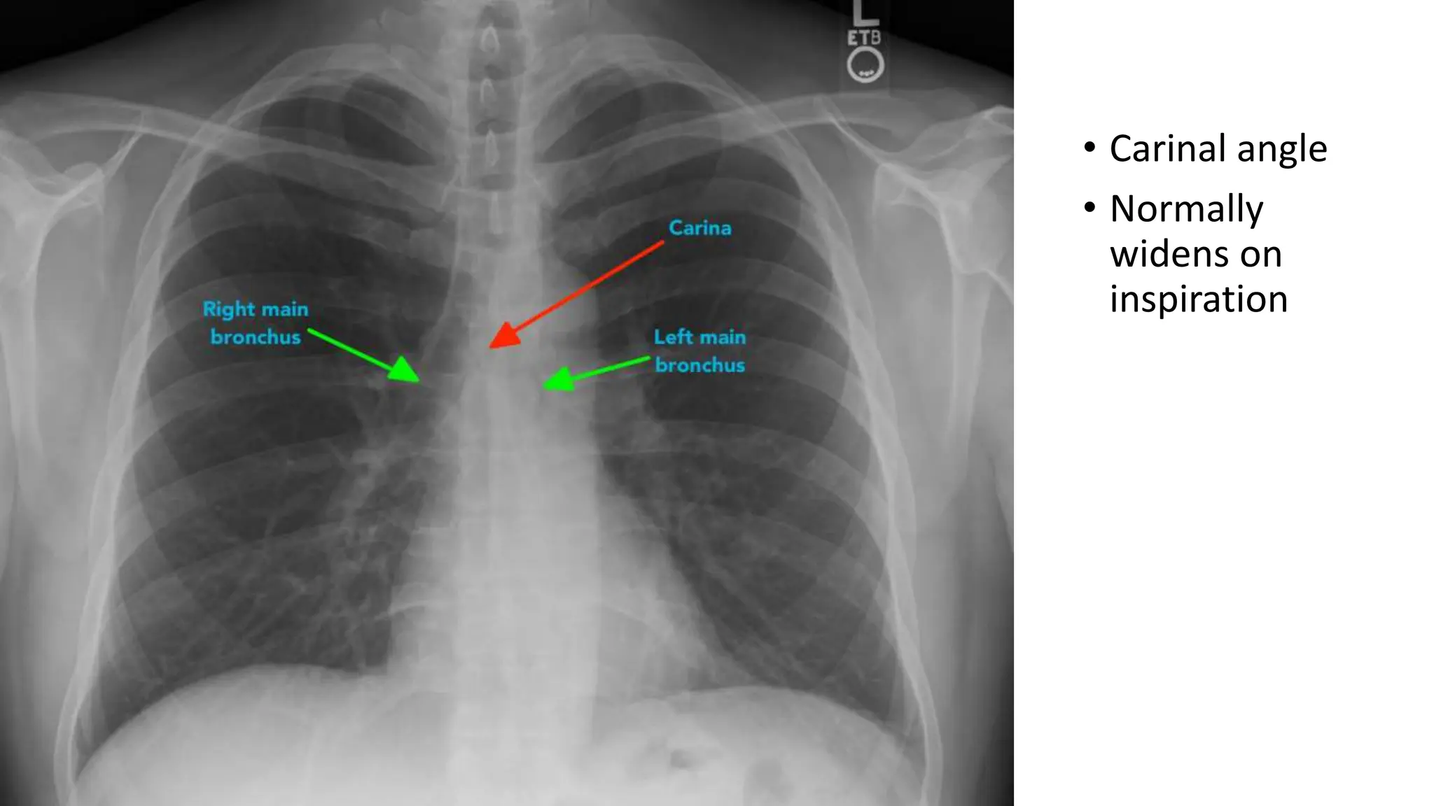 anatomy thorax human title radiologi positioning | PPTX