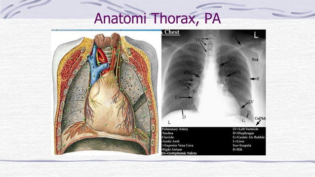 anatomy thorax human title radiologi positioning | PPT