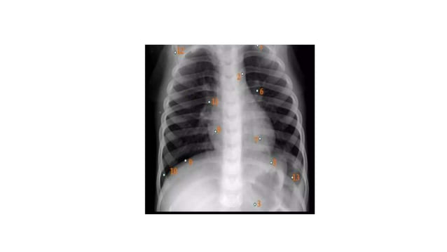anatomy thorax human title radiologi positioning | PPT