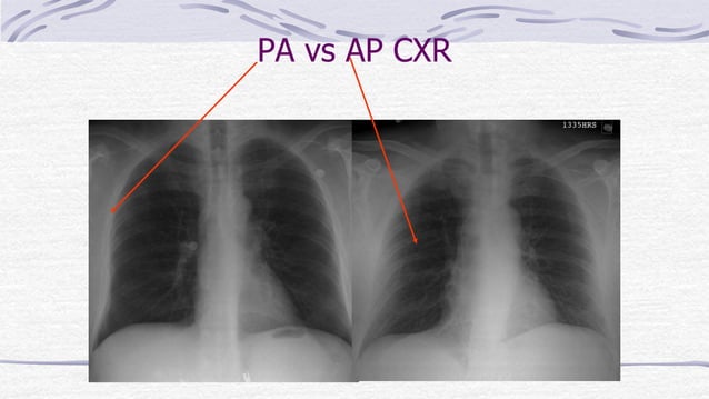 anatomy thorax human title radiologi positioning | PPT