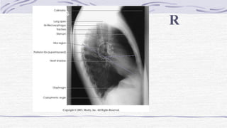 anatomy thorax human title radiologi positioning | PPTX