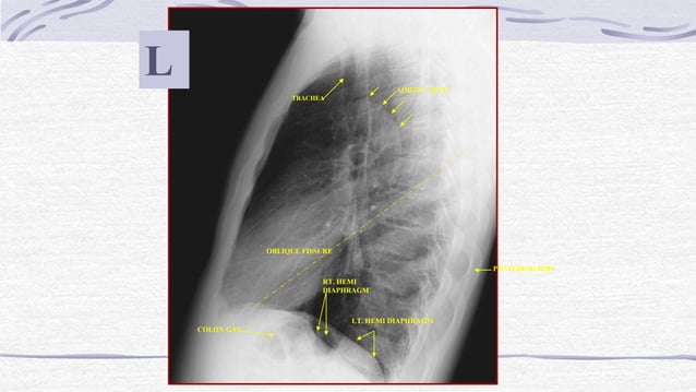 anatomy thorax human title radiologi positioning | PPT