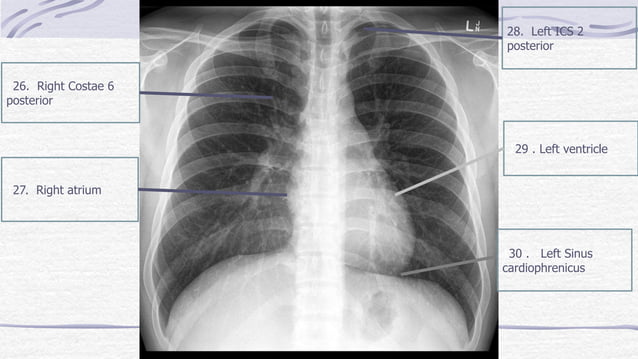 anatomy thorax human title radiologi positioning | PPT