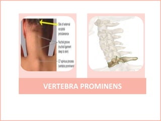 Cervical Vertebrae & cervical spondylosis | PPTX