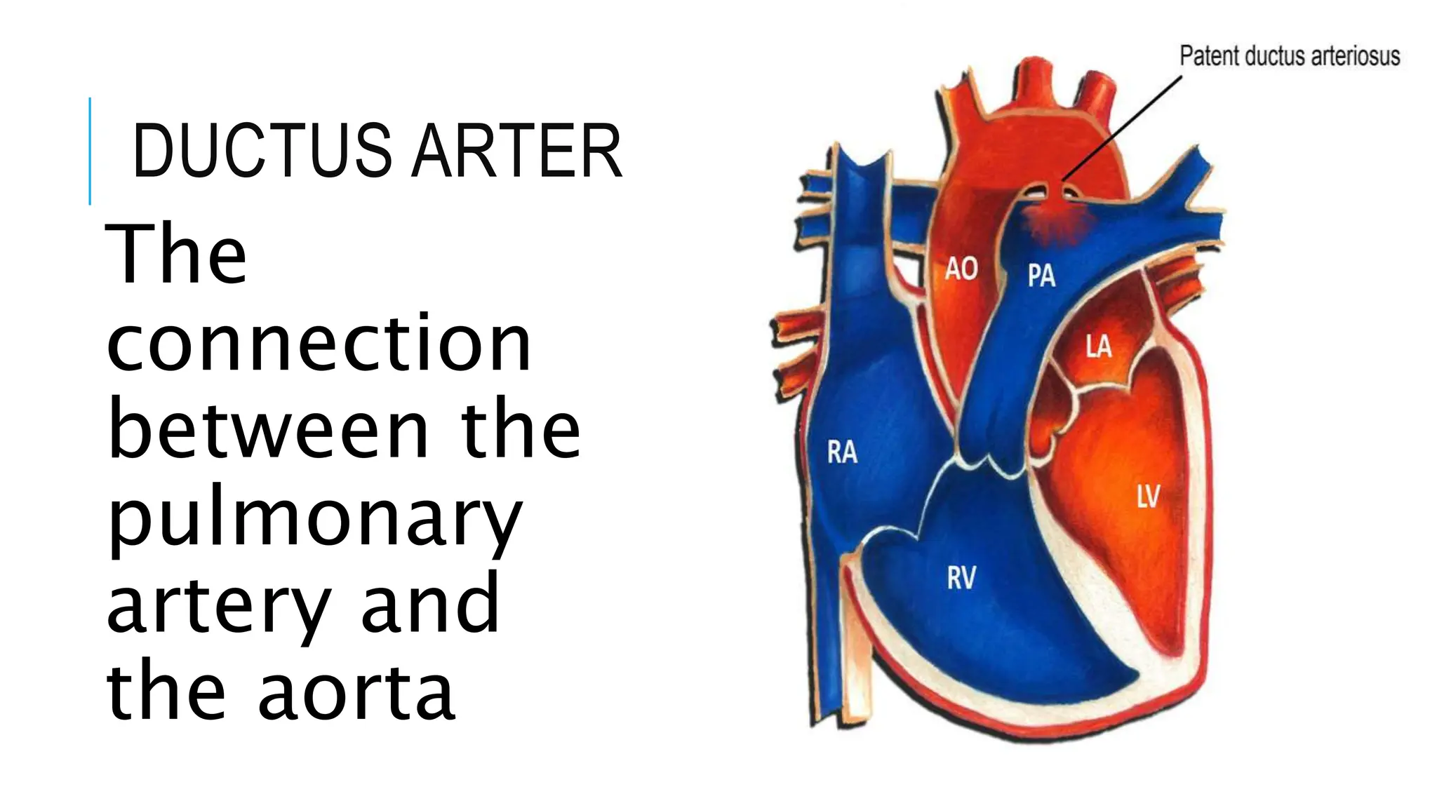 Fetal Circulation Pathway Shunts And Remnants Ppt