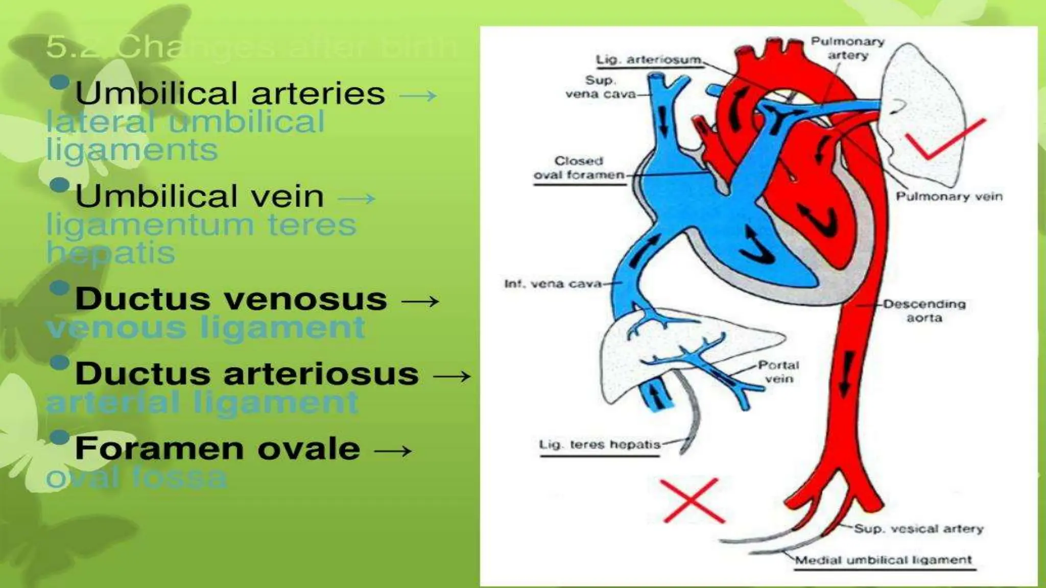 Fetal Circulation, pathway, shunts and remnants | PPTX