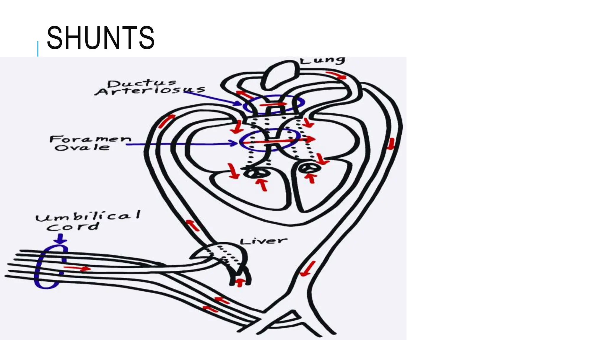 Fetal Circulation, pathway, shunts and remnants | PPTX
