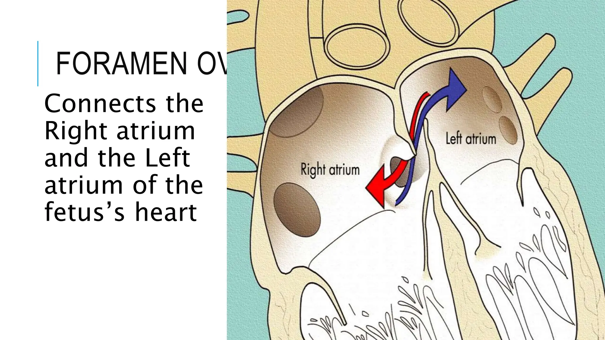 Fetal Circulation Pathway Shunts And Remnants Ppt