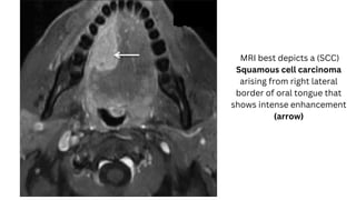 anatomy of GIT through Radiology imaging.pdf