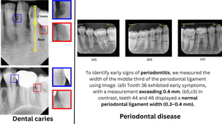 anatomy of GIT through Radiology imaging.pdf