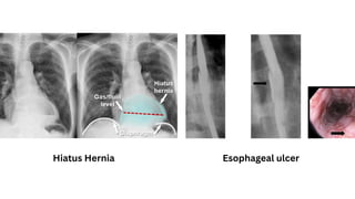anatomy of GIT through Radiology imaging.pdf