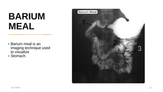 anatomy of GIT through Radiology imaging.pdf