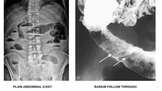 anatomy of GIT through Radiology imaging.pdf