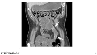 anatomy of GIT through Radiology imaging.pdf