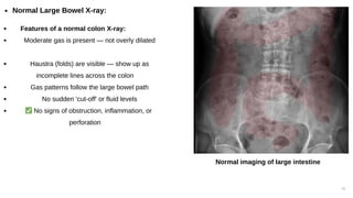 anatomy of GIT through Radiology imaging.pdf