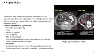 anatomy of GIT through Radiology imaging.pdf