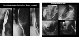 anatomy of GIT through Radiology imaging.pdf
