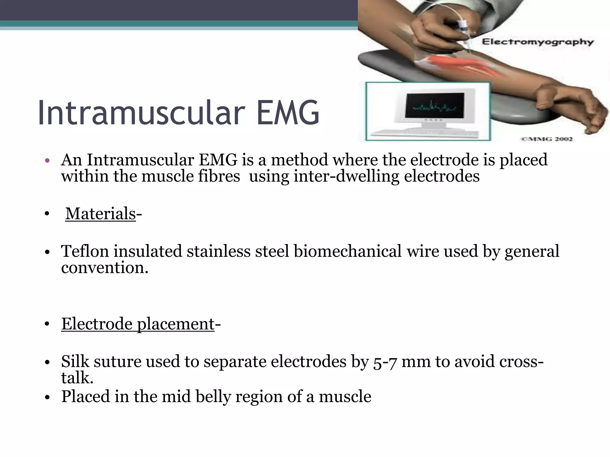 Anatomy project emg | PPT