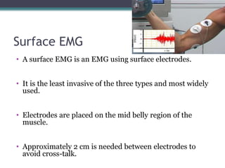 Anatomy project emg | PPT