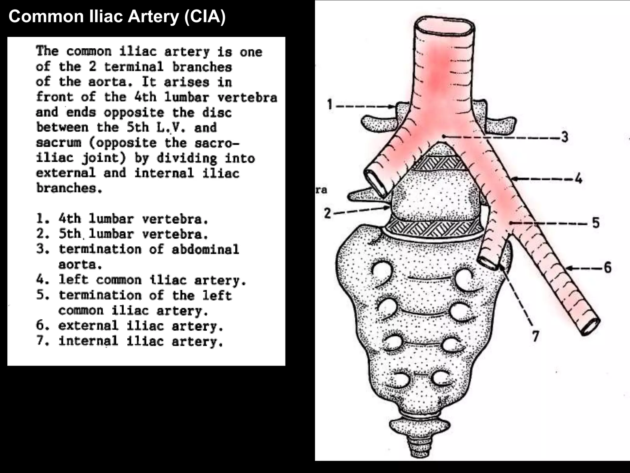 Anatomy & Radiology of pelvis | PPTX