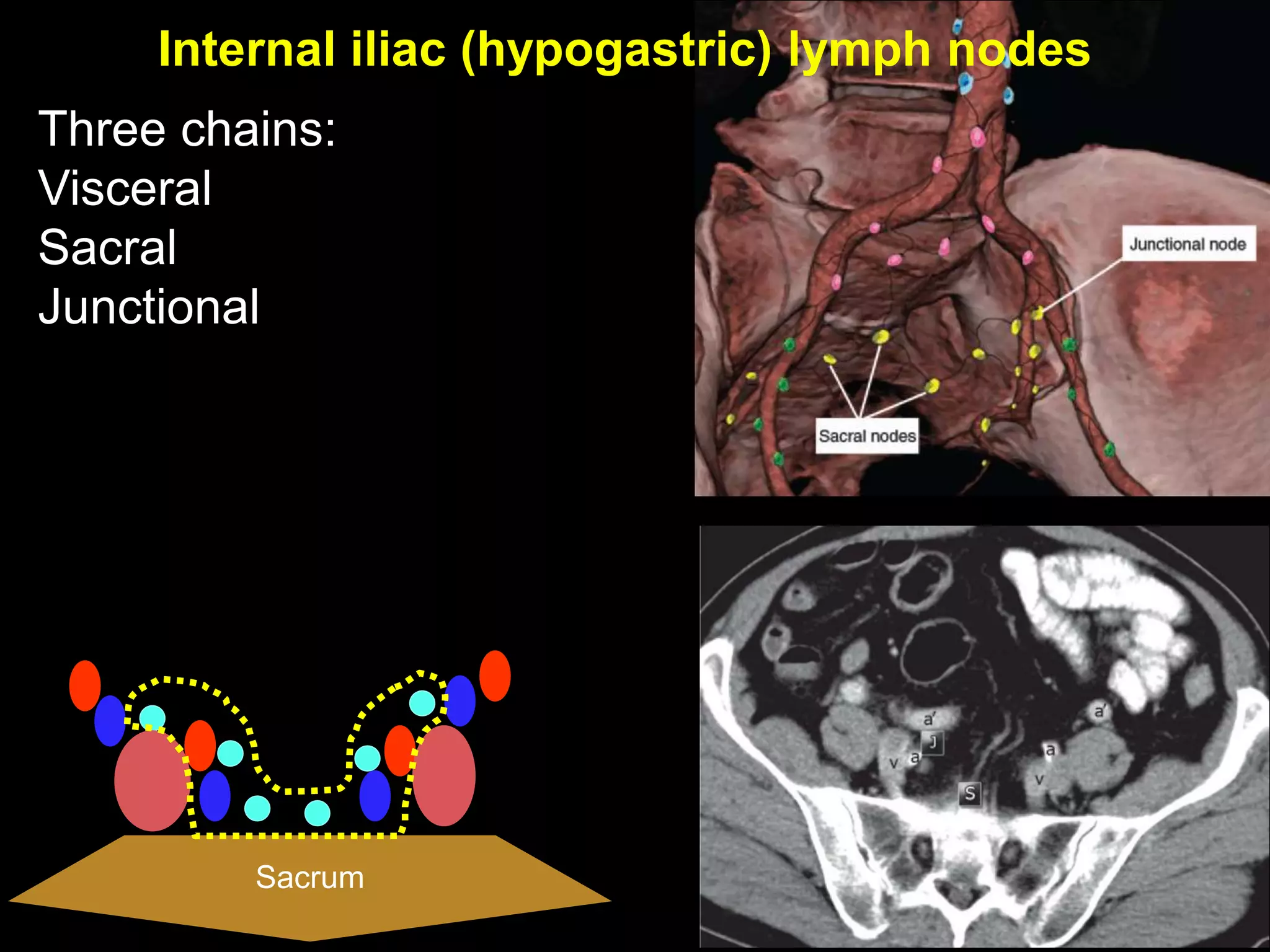 Anatomy & Radiology of pelvis | PPTX