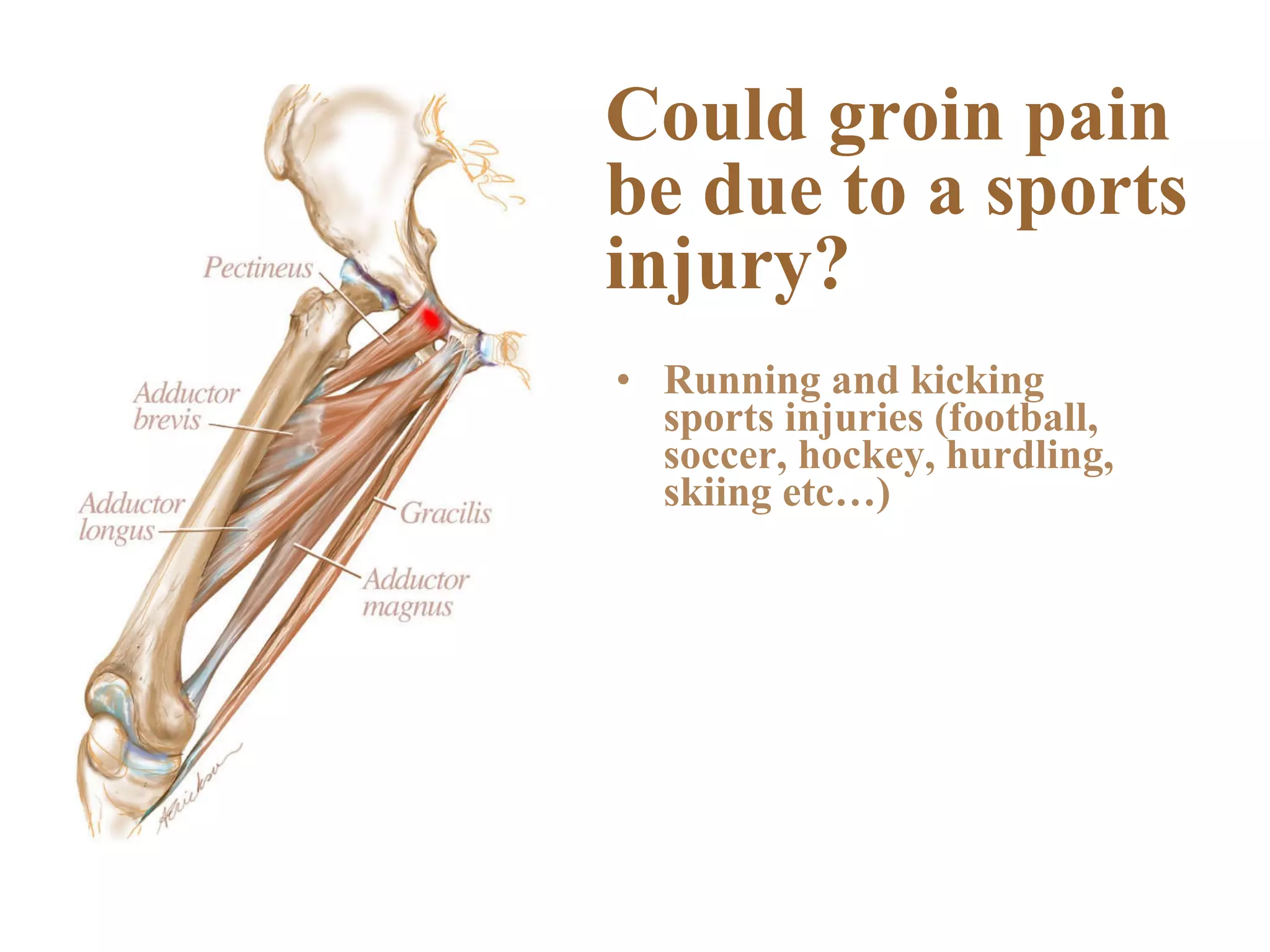 Anatomy and Related Etiology of Groin Pain | PPT
