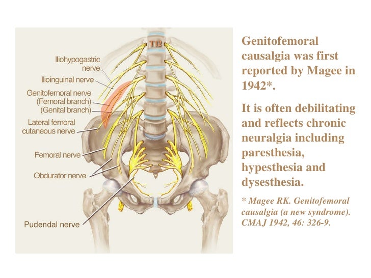 Ilioinguinal Nerve Anatomy