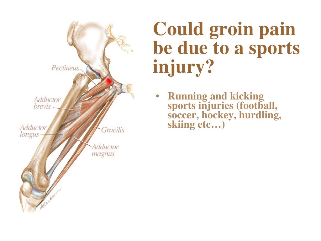 Anatomy and Related Etiology of Groin Pain