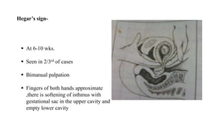 Anatomy related to obstetrics (U G).pptx