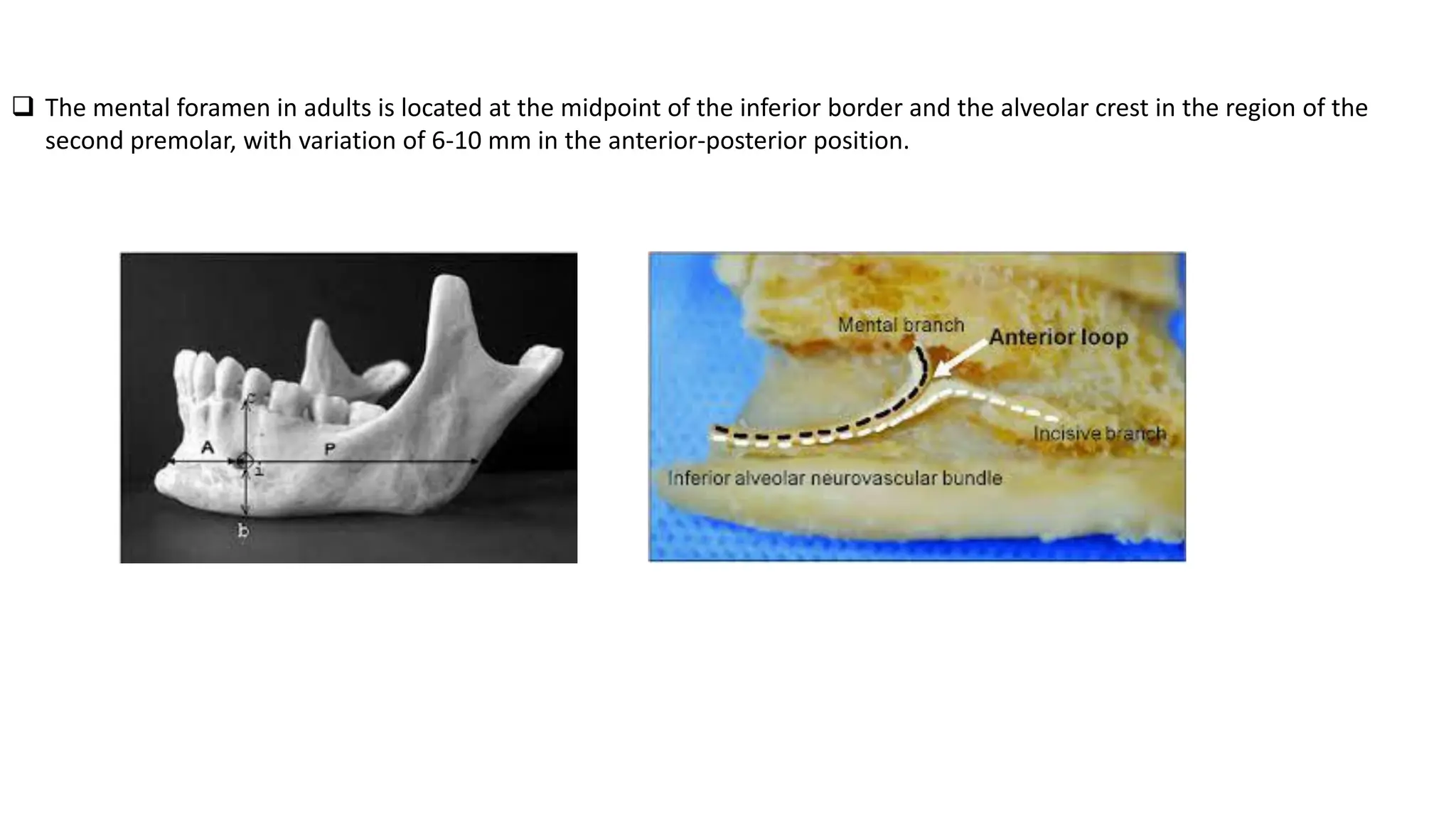 Anatomy relevent to Dental Implantology.pdf