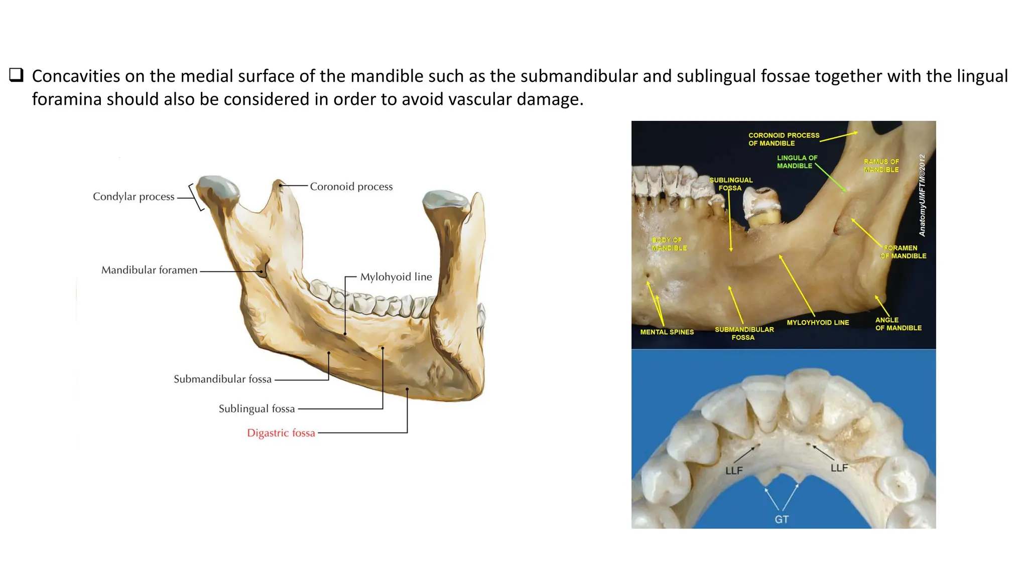 Anatomy relevent to Dental Implantology.pdf
