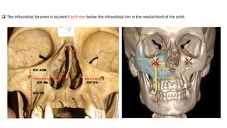 Anatomy relevent to Dental Implantology.pdf