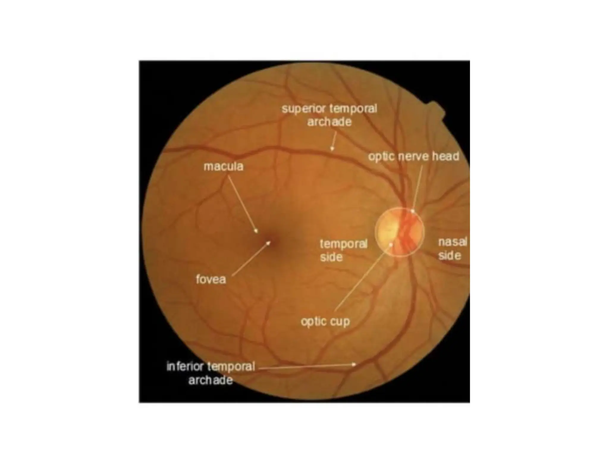 Anatomy of the Retina (ophthalmology).pptx