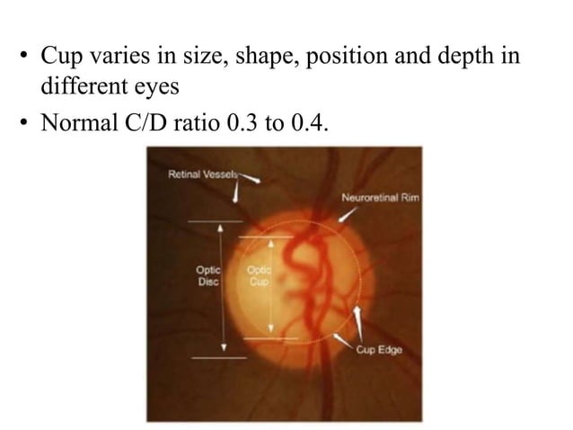 Anatomy of the Retina (ophthalmology).pptx