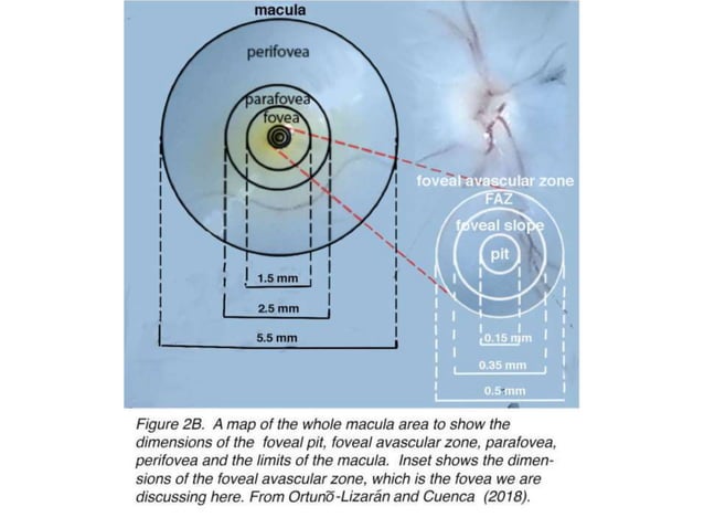 Anatomy of the Retina (ophthalmology).pptx
