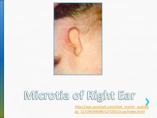 Anatomy of the Auditory System: A Review | PPTX