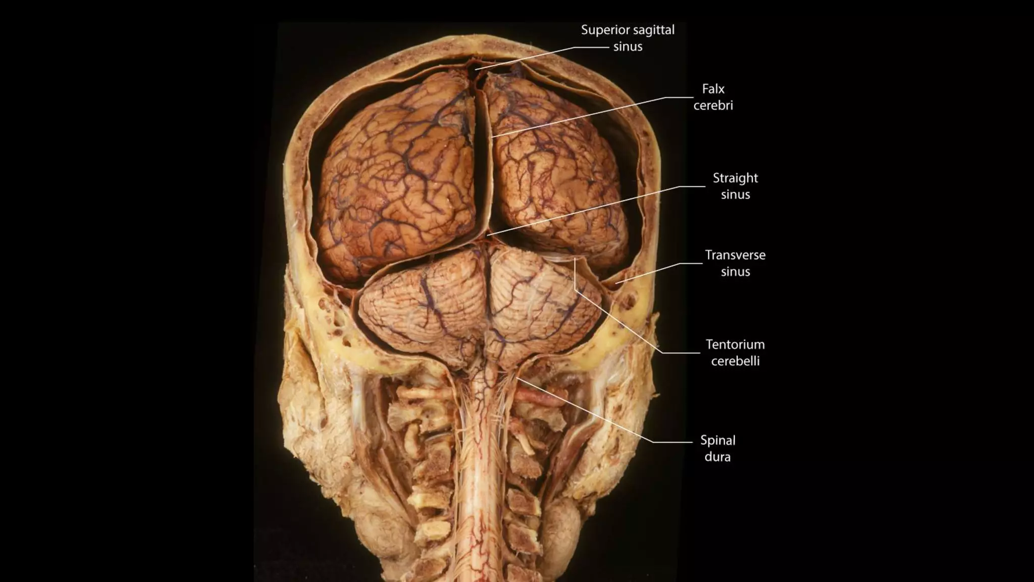 Anatomy skull anatomy dr.mohammed | PPT