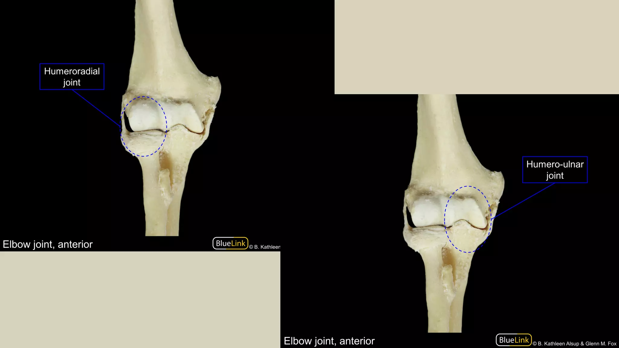 Anatomy SSS Demo Class (Elbow Bones).pdf