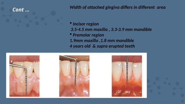 Anatomy ,structure & function of periodontium.pptx | Dental Health ...