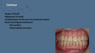 Anatomy ,structure & function of periodontium.pptx