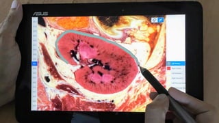 Anatomy Studio: a Tool for Virtual Dissection Through Augmented 3D ...