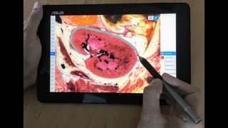 Anatomy Studio: a Tool for Virtual Dissection Through Augmented 3D ...