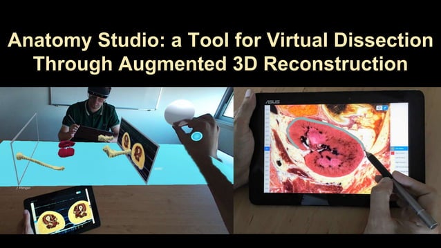Anatomy Studio: a Tool for Virtual Dissection Through Augmented 3D ...