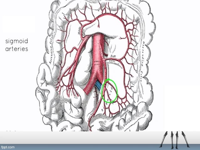 Anatomy superior Mesenteric artery | PPT