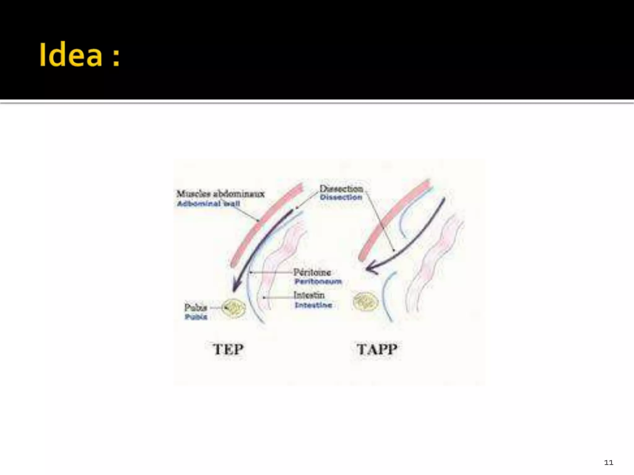 Anatomy & technique of the laparoscopic totally extra peritoneal | PPTX