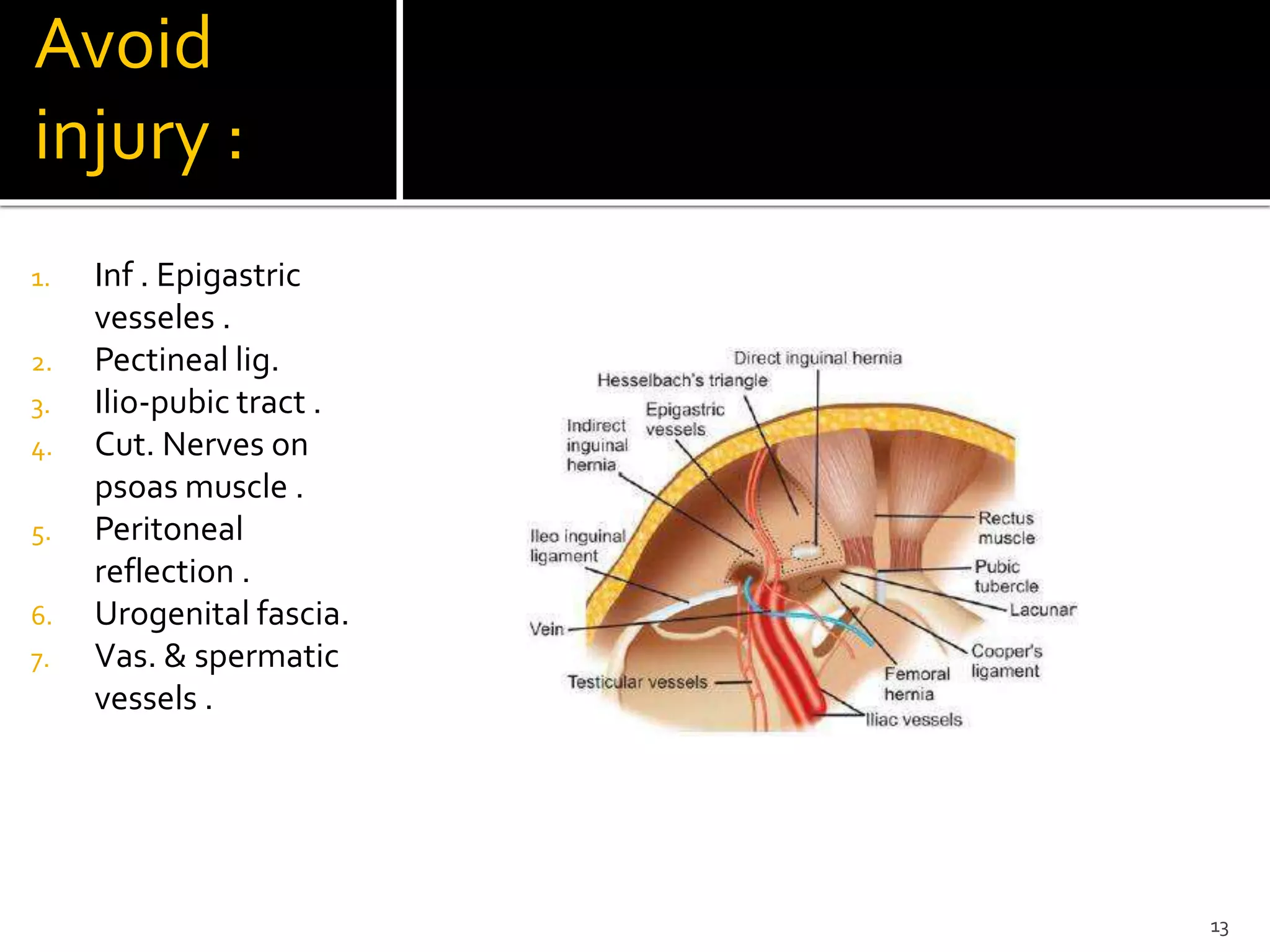 Anatomy & technique of the laparoscopic totally extra peritoneal | PPTX