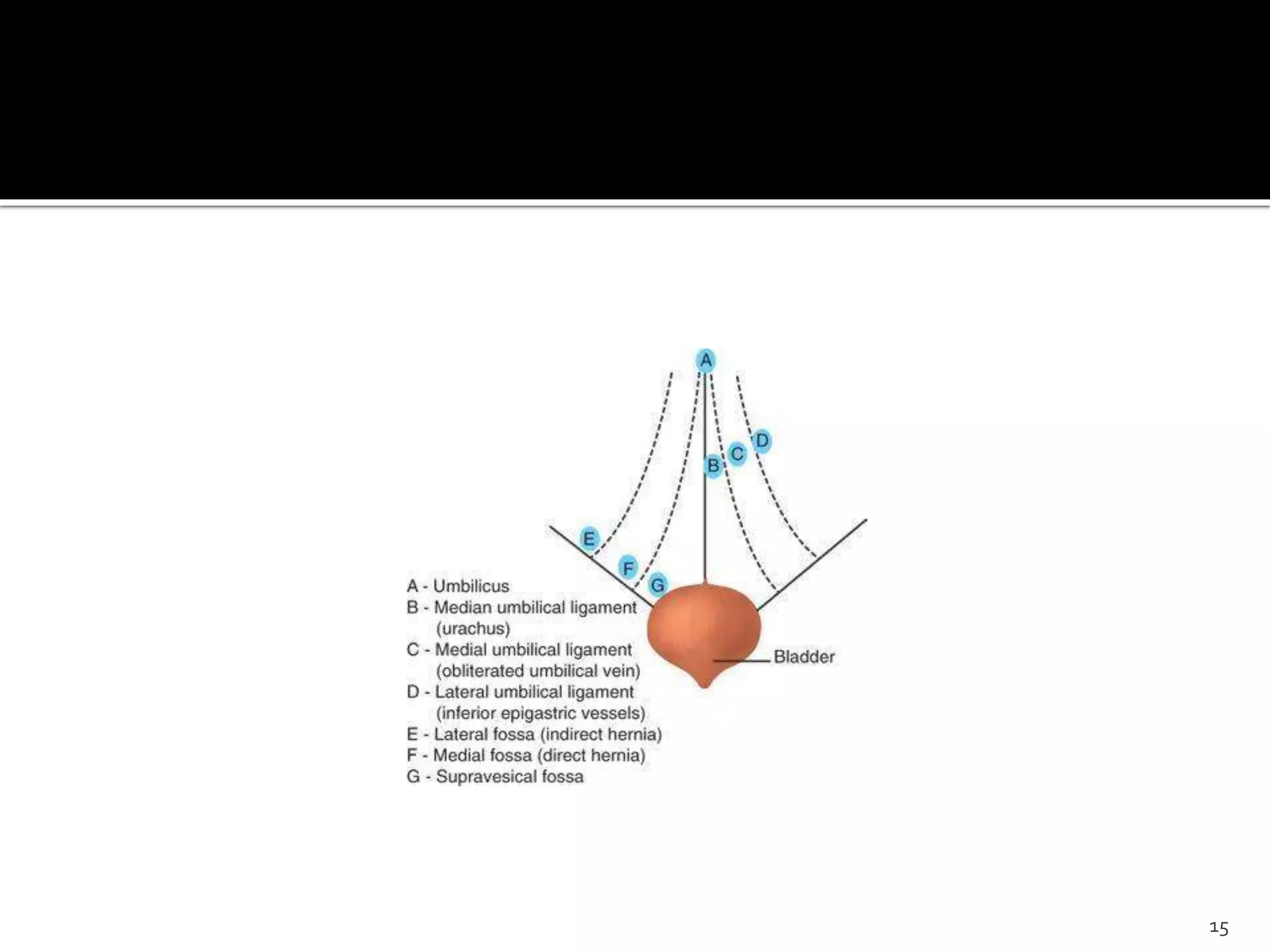 Anatomy & technique of the laparoscopic totally extra peritoneal | PPTX