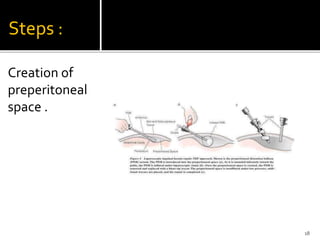 Anatomy & technique of the laparoscopic totally extra peritoneal | PPTX